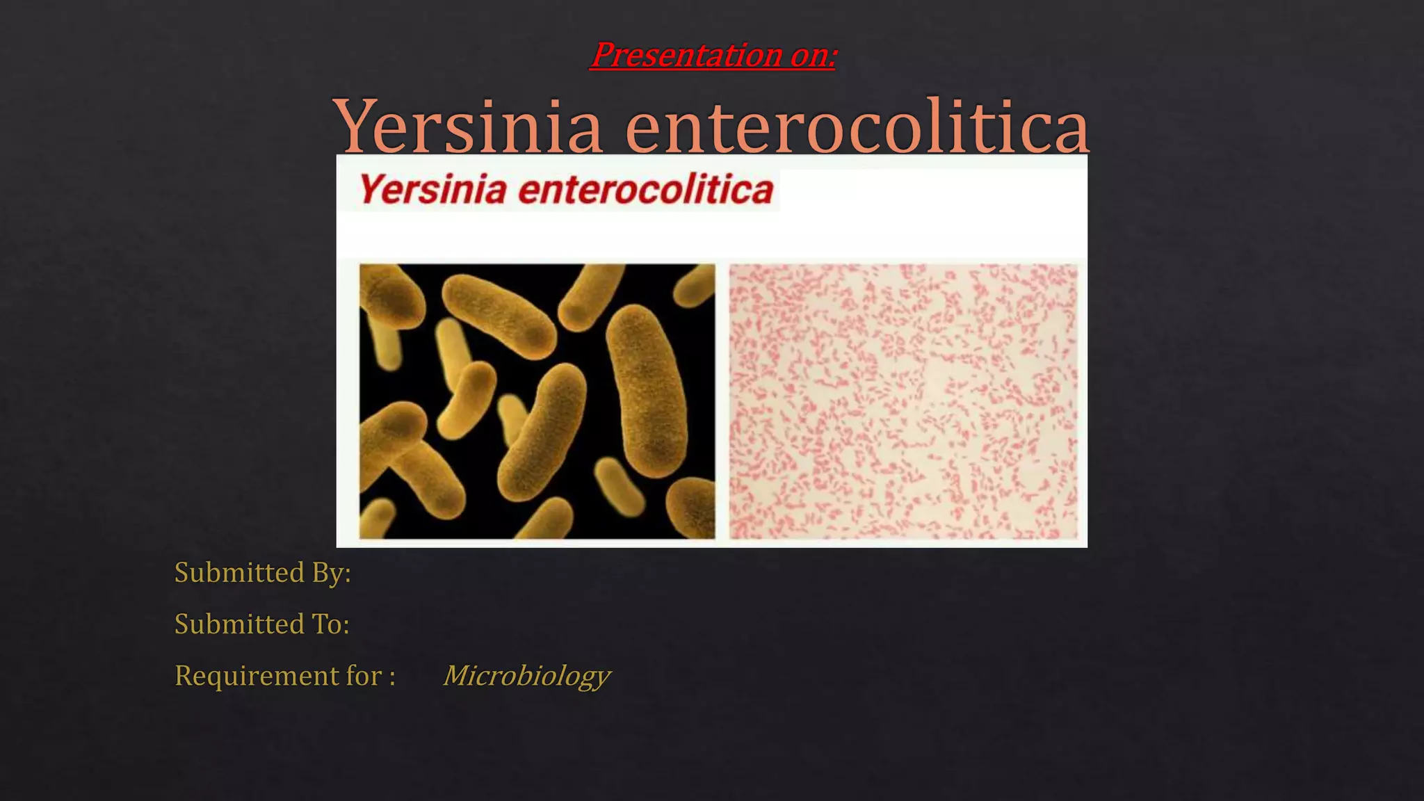 Yersinia enterocolitica | PPTX