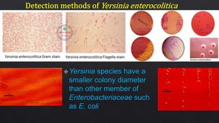 Yersinia enterocolitica | PPTX