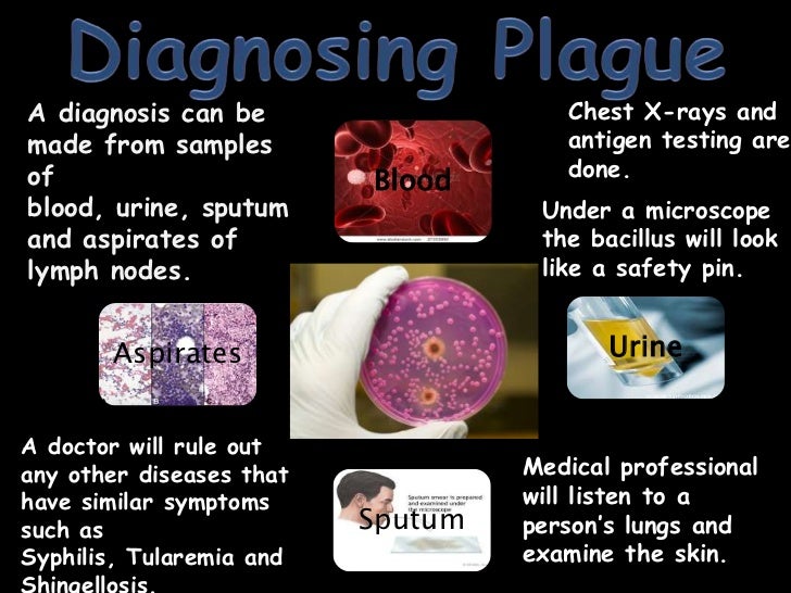 Signs And Symptoms Of Yersinia Pestis at Sandra Mathers blog