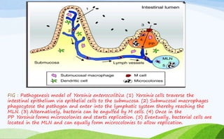 Yersinia entero | PPTX