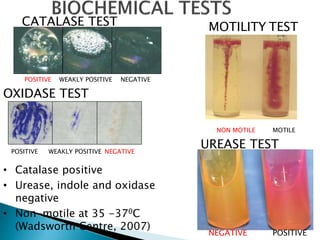 Yersinia pestis ..... | PPTX