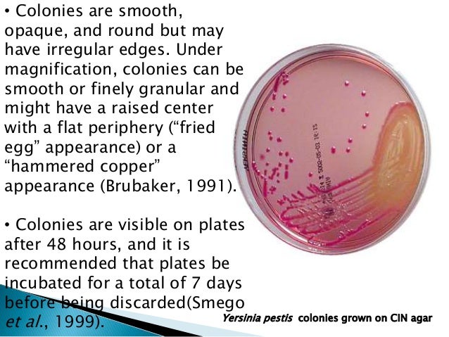 Yersinia pestis .....
