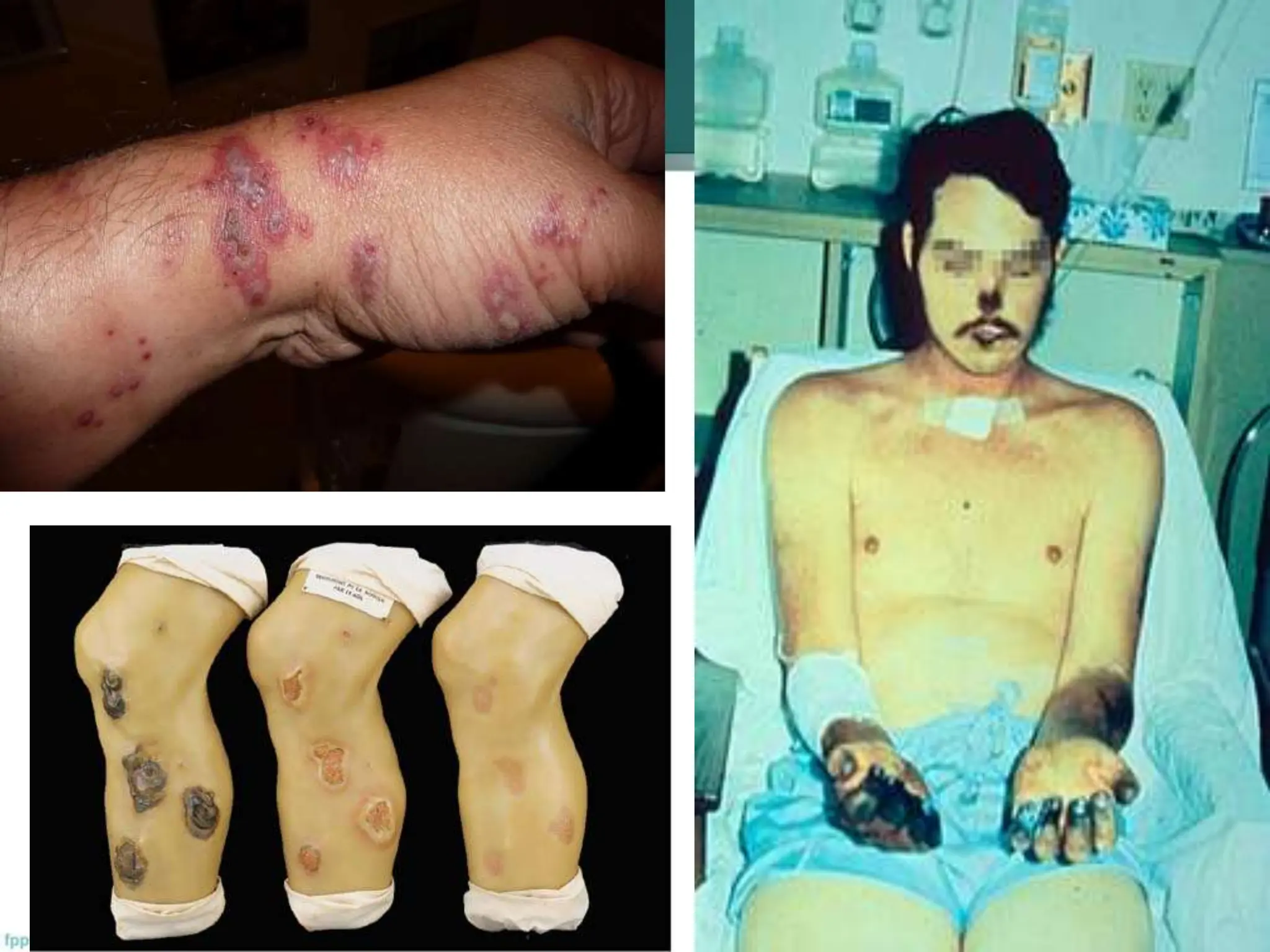 Yersinia pestis- lec6 bacteriology therory.pptx