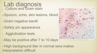 YERSINIOSIS, STREPTOCOCCUS SUIS, GLANDERS.pptx