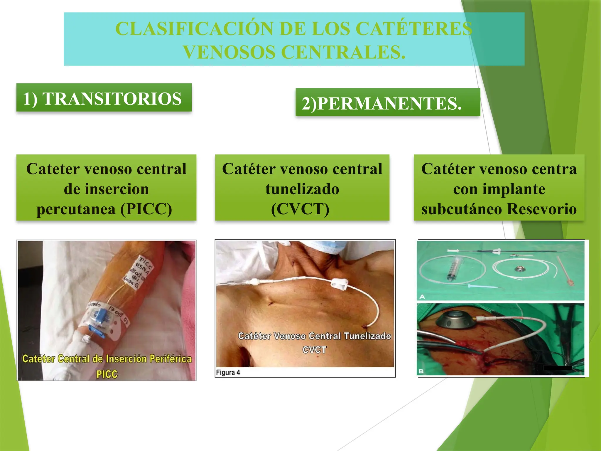 YESENIA CVC CATETER VENOSO CENTRAL HNHU.pptx