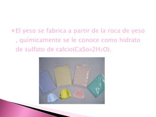 Yesos dentales | PPT