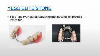 Yesos dentales 2 | PPTX