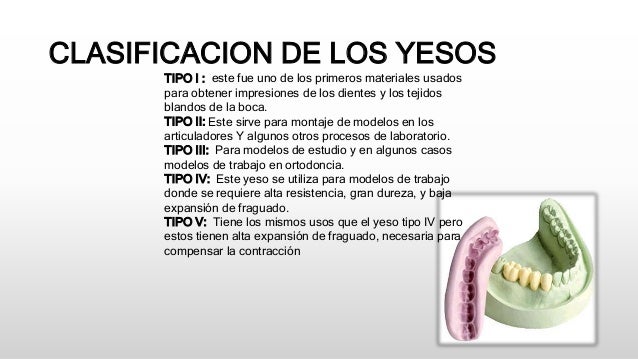 Yesos dentales 2