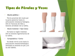 YESO Y FERULA. MTRO. DENIS HENESTROZA.pptx