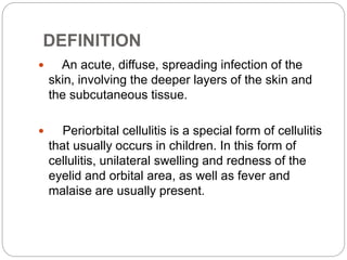 Cellulitis | PPT