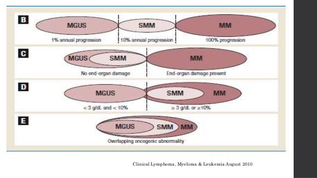 smoldering myeloma