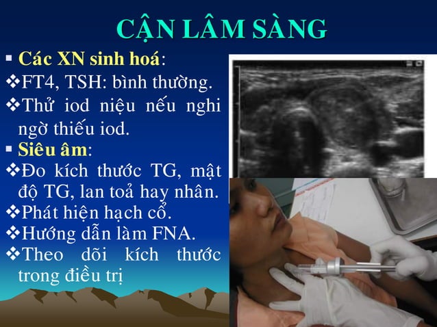 Benh hoc he noi tiet | PDF