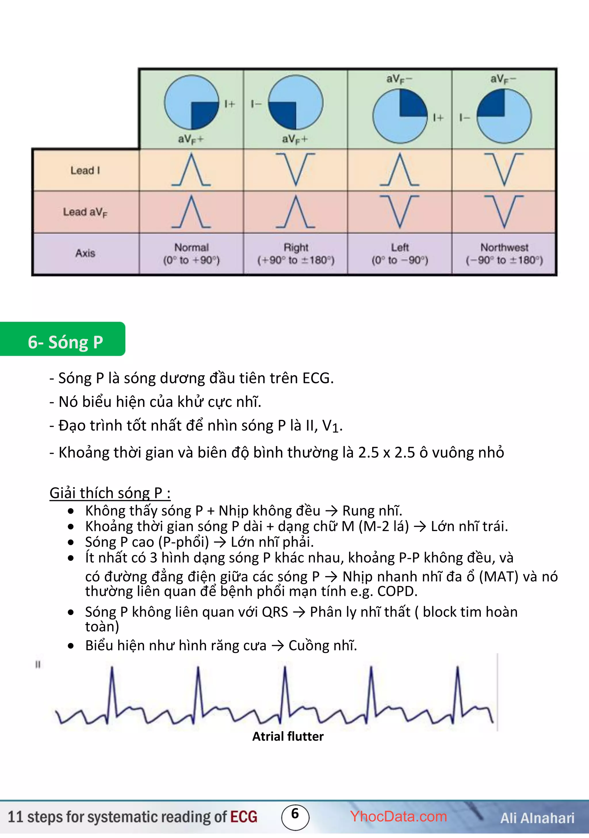 [YhocData.com] Bản Dịch 11 Bước Đọc ECG | PDF