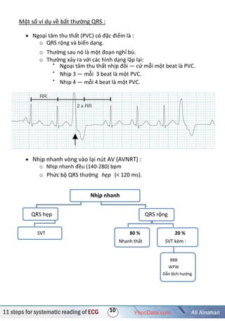 [YhocData.com] Bản Dịch 11 Bước Đọc ECG | PDF