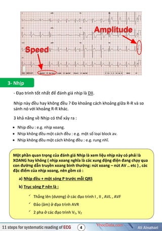 [YhocData.com] Bản Dịch 11 Bước Đọc ECG | PDF