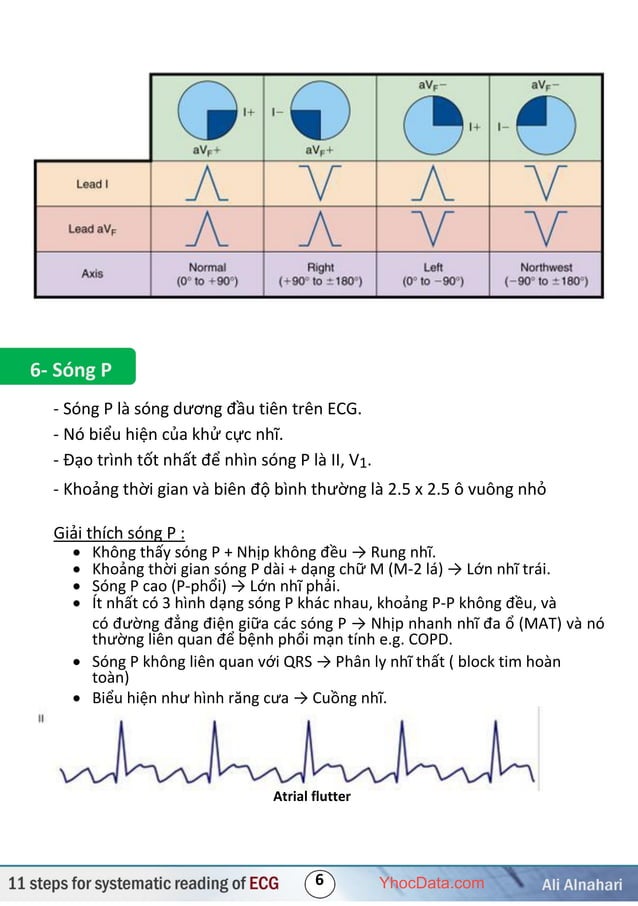 [YhocData.com] Bản Dịch 11 Bước Đọc ECG | PDF