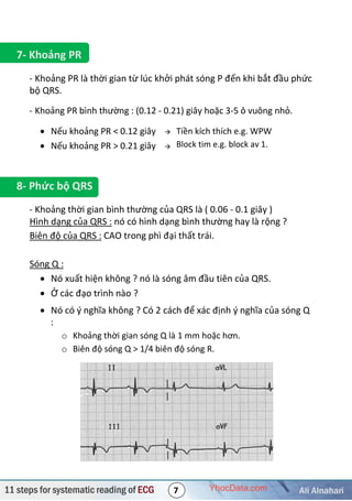 [YhocData.com] Bản Dịch 11 Bước Đọc ECG | PDF