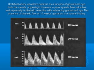 Umbilical Artery Doppler Normal Values