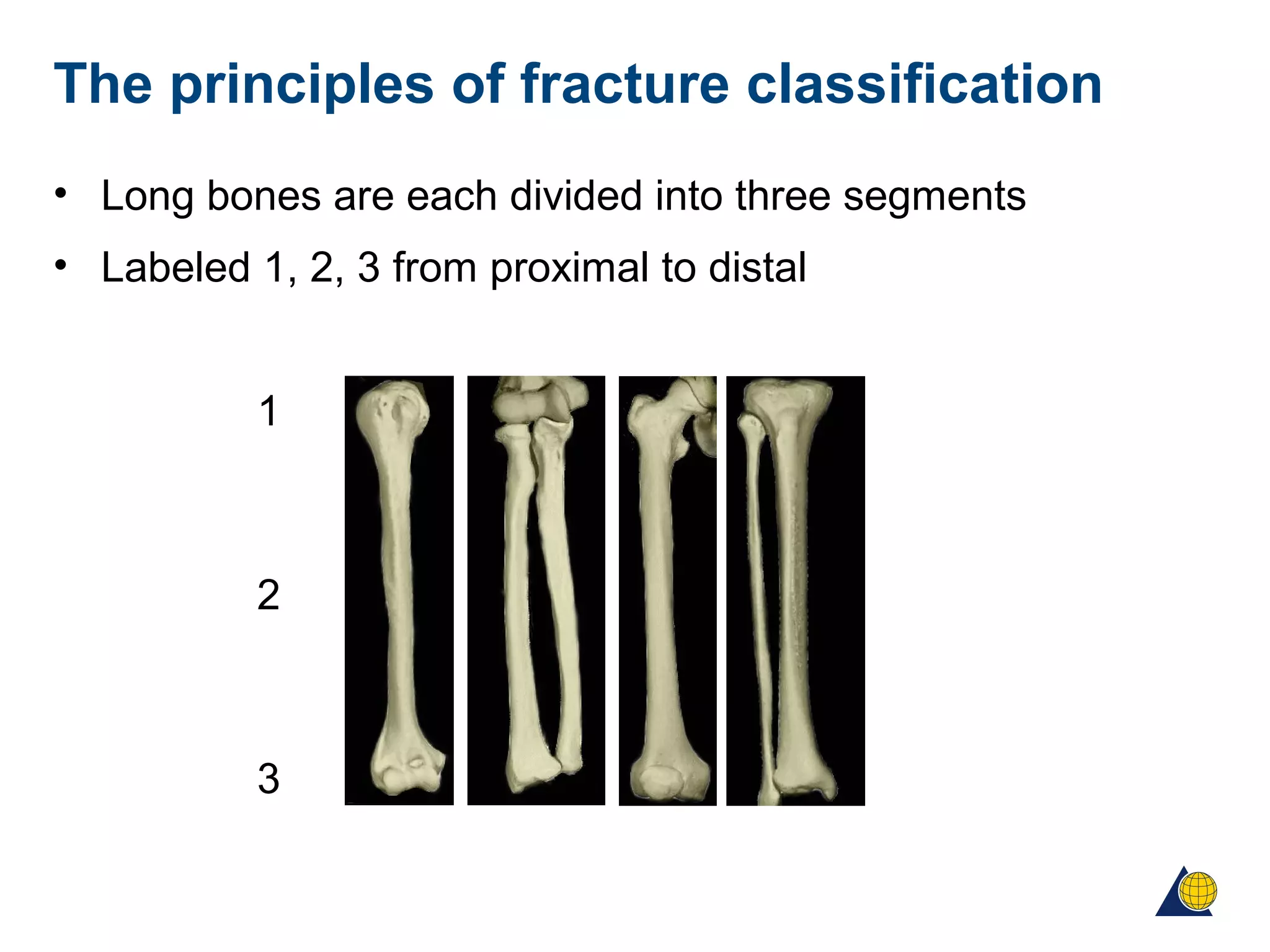 AO Classification | PPT