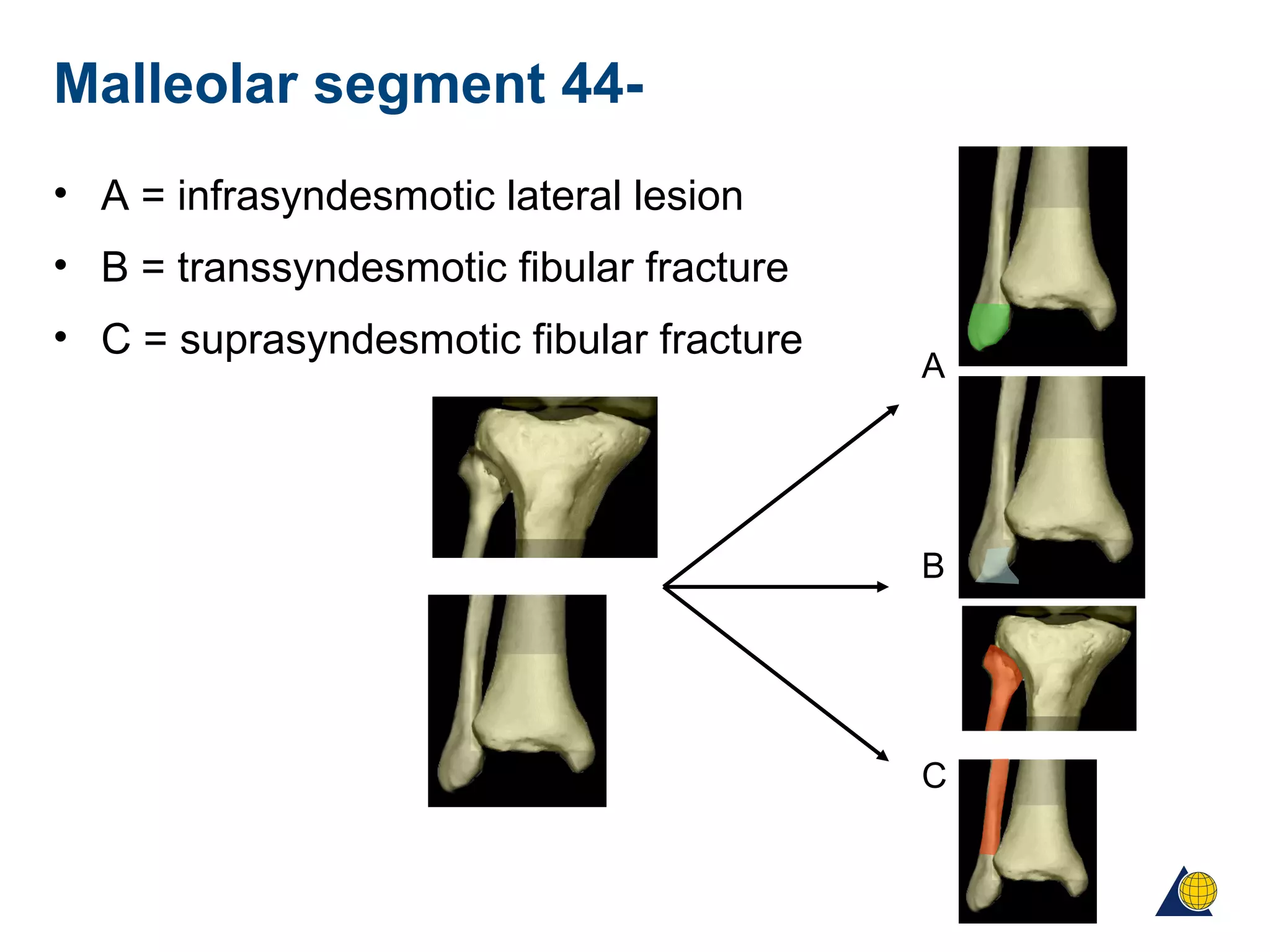 AO Classification | PPT