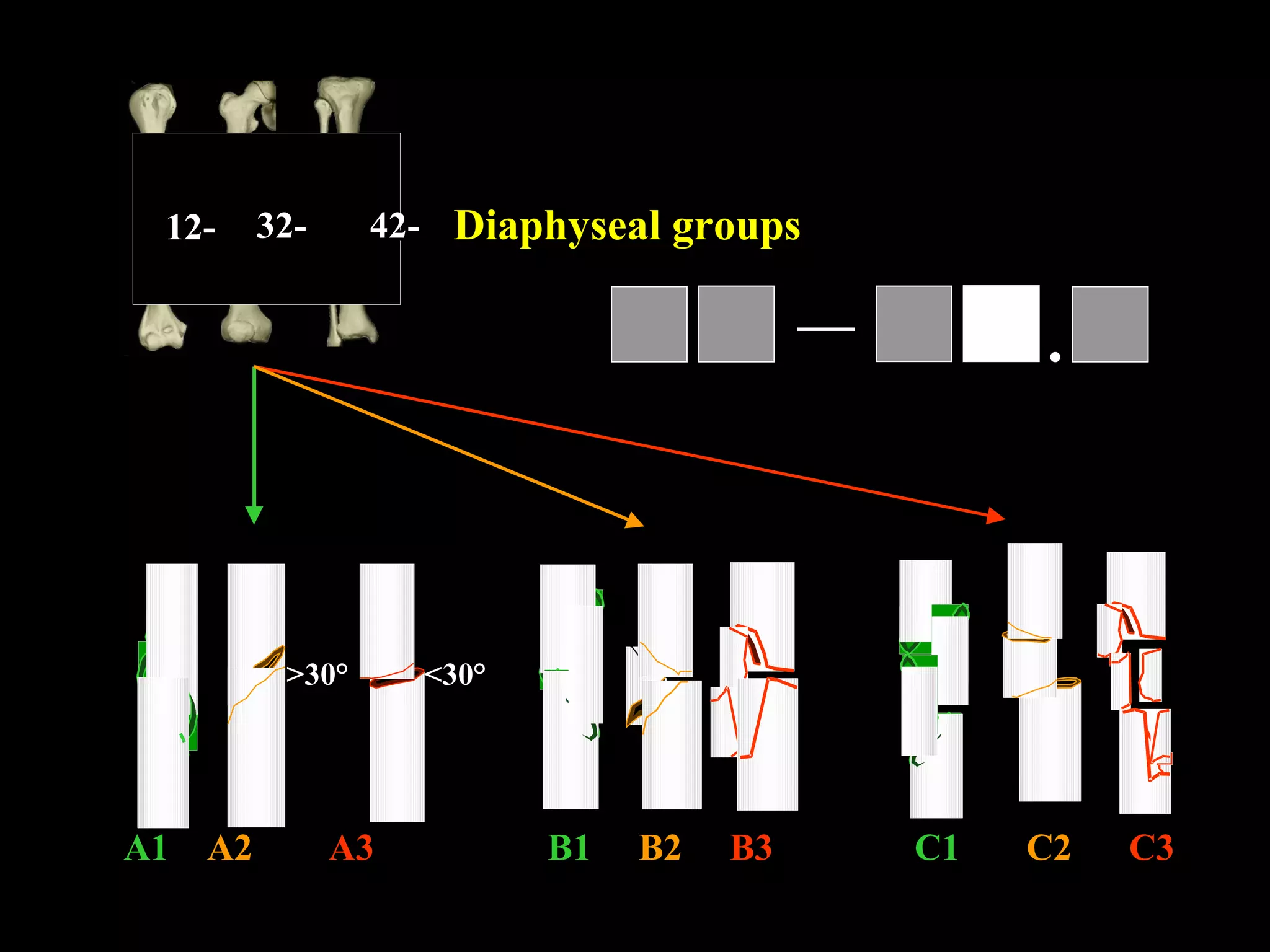 AO Classification | PPT