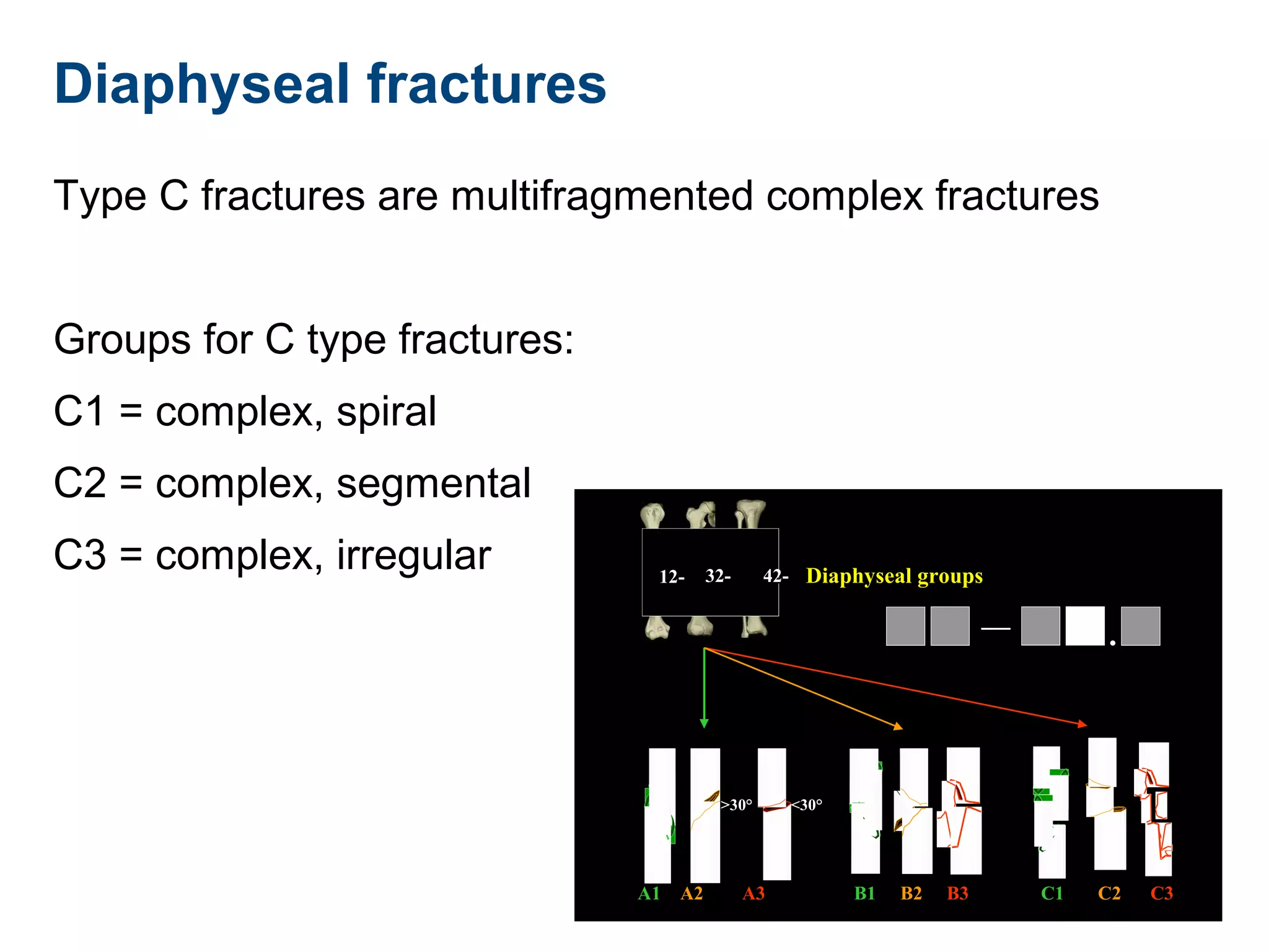 AO Classification | PPT