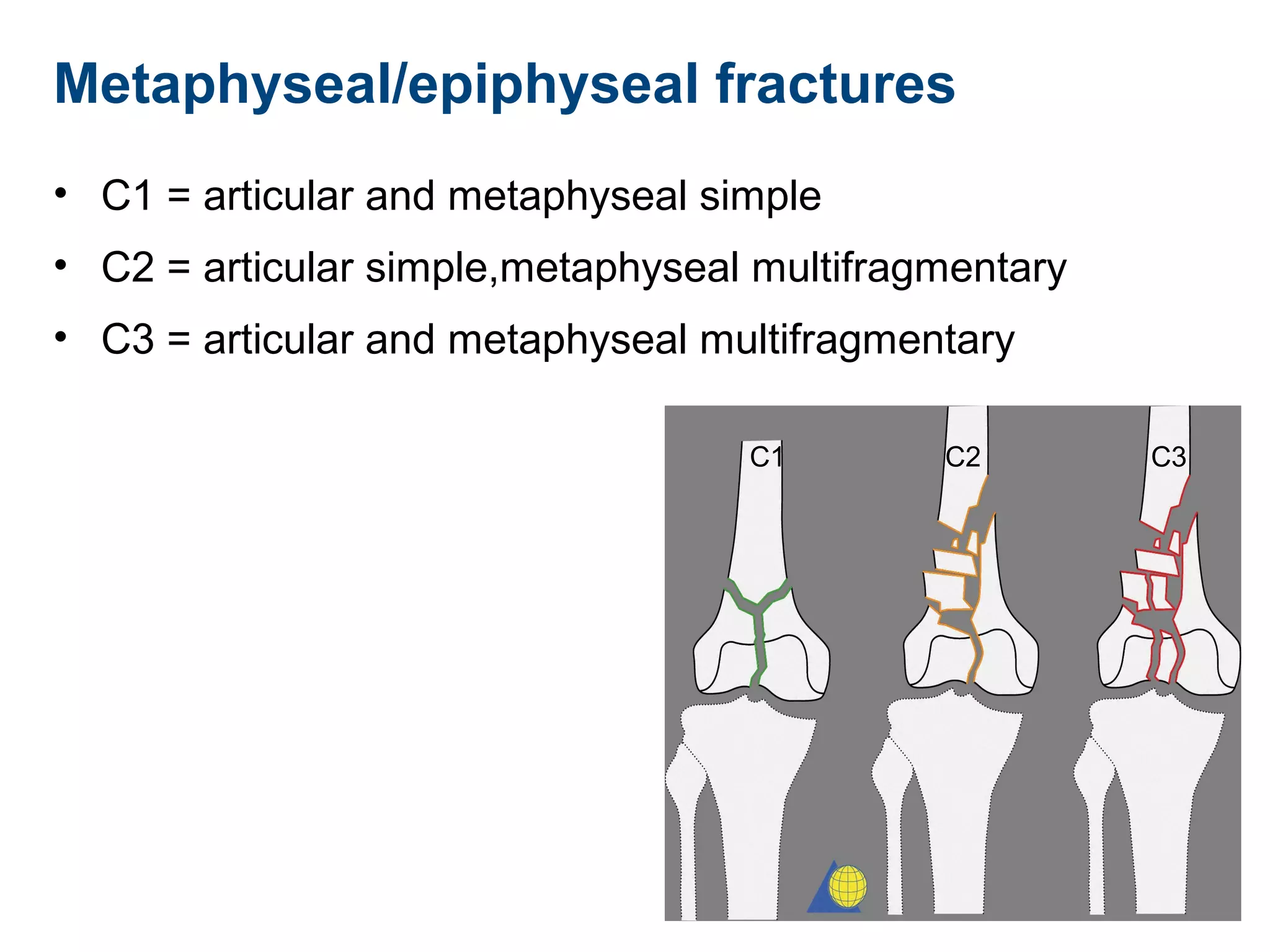AO Classification | PPT