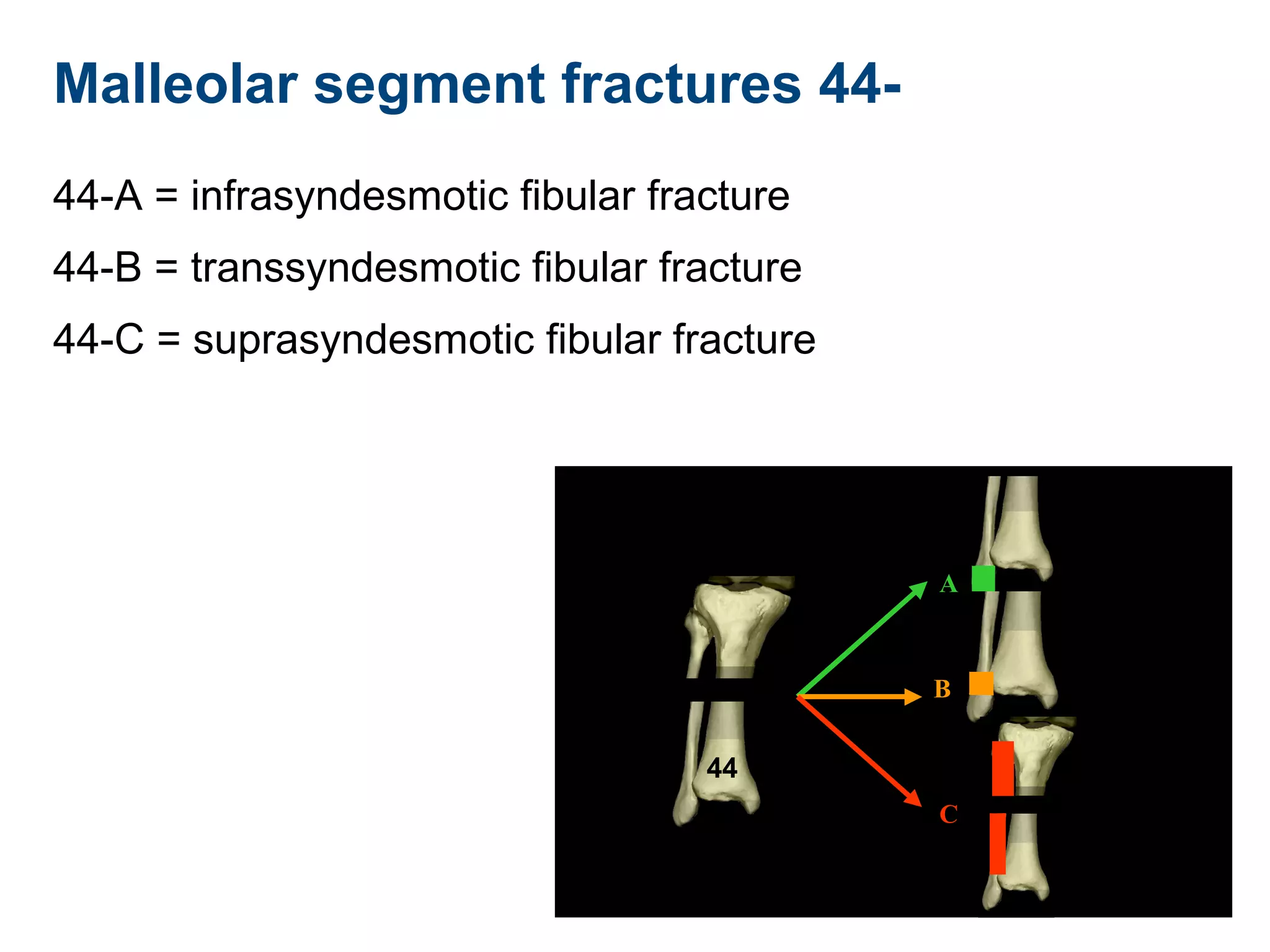 AO Classification | PPT