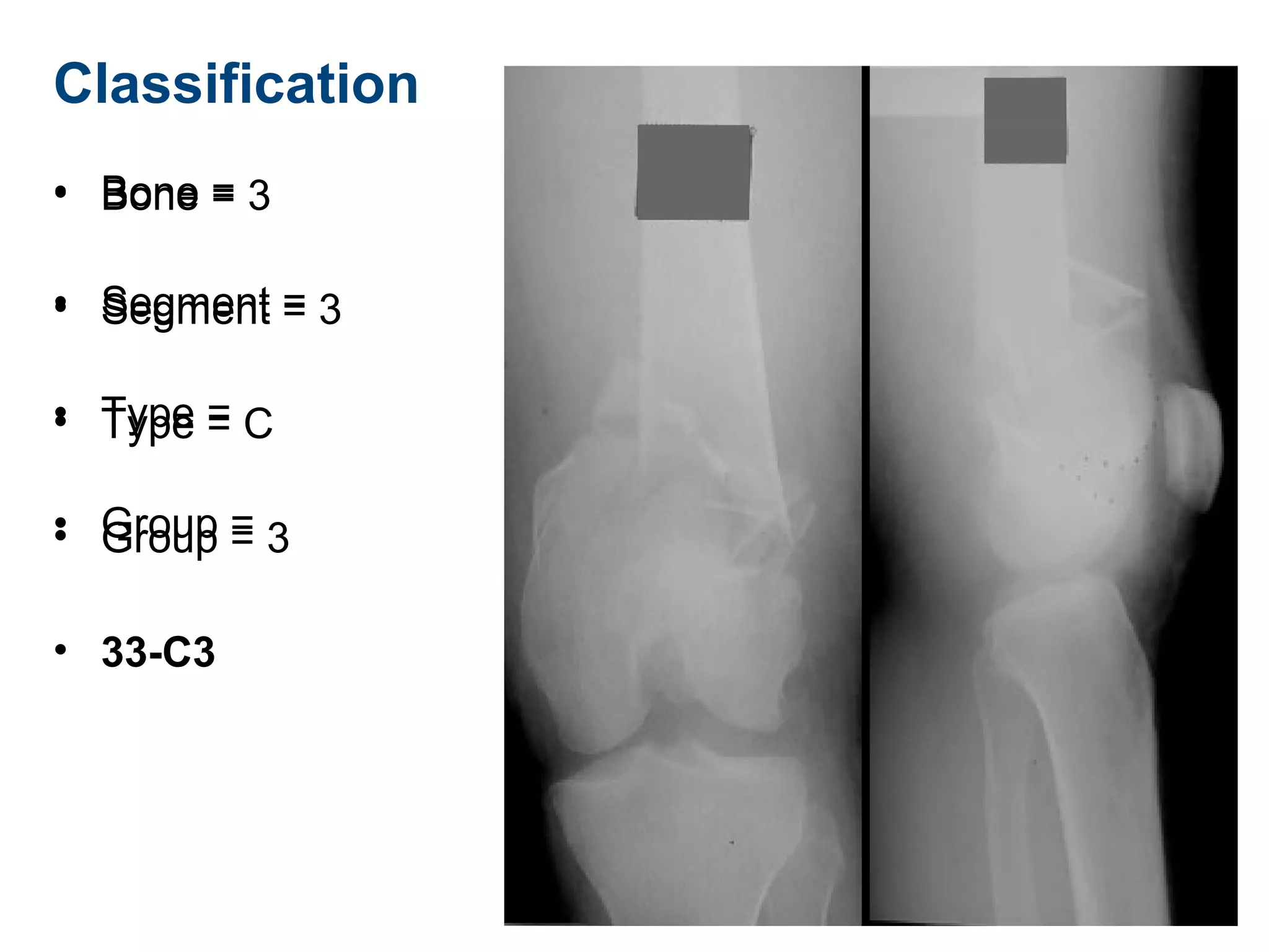 AO Classification | PPT