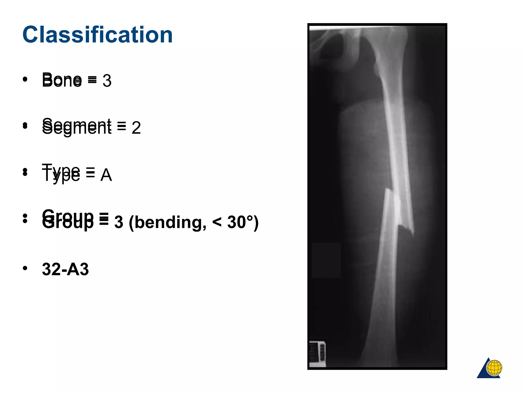 AO Classification | PPT