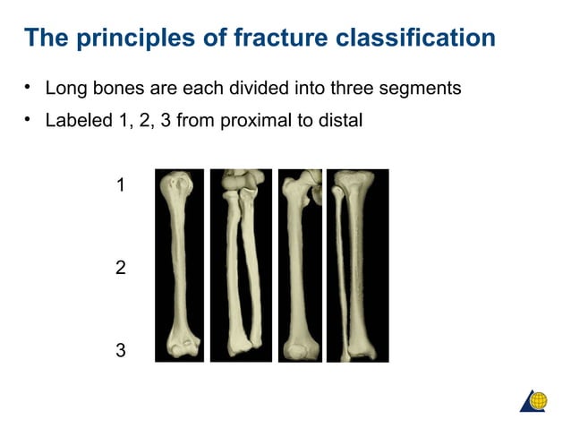 AO Classification | PPT