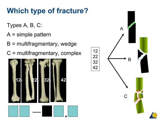 AO Classification | PPT