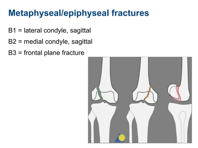 AO Classification | PPT