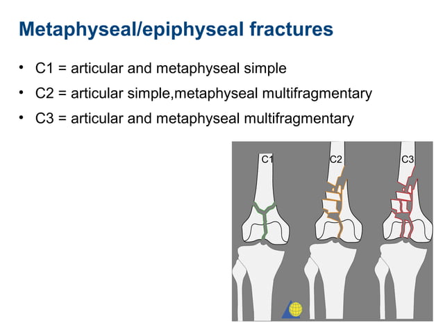 AO Classification | PPT
