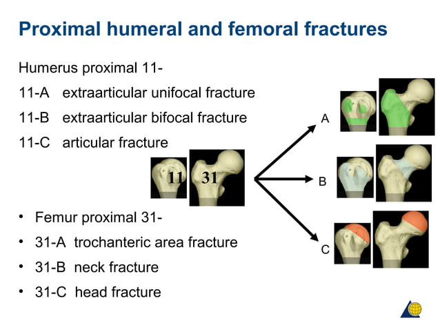 AO Classification | PPT