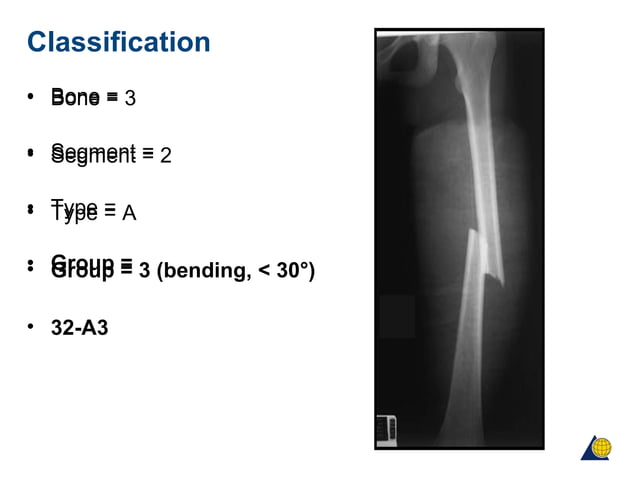 AO Classification | PPT