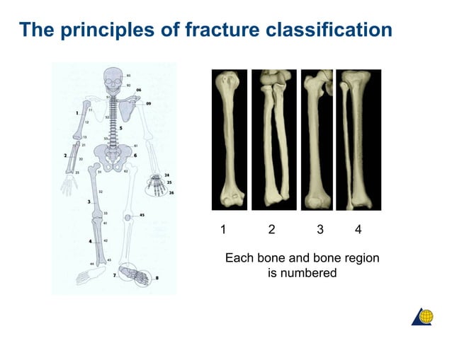 AO Classification | PPT