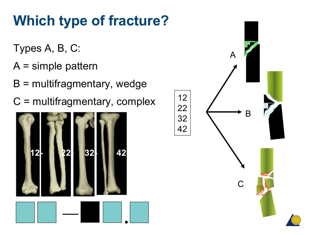 AO Classification