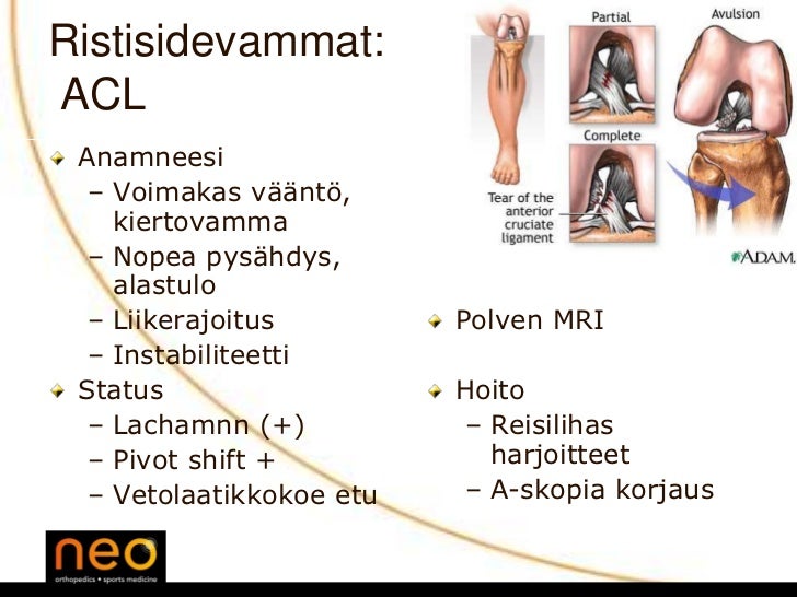 Tyypilliset urheilijan nilkka- ja polvivammat ja niiden ennaltaehkäisy