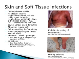 Empiric antibiotic management for major infections | PPTX