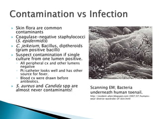 Empiric antibiotic management for major infections | PPTX