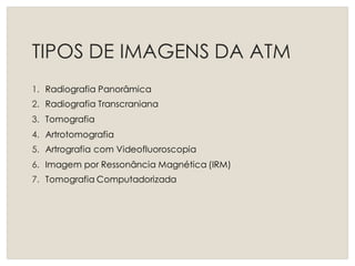 Conteúdo inédito de Imaginologia da ATM 1 | PDF