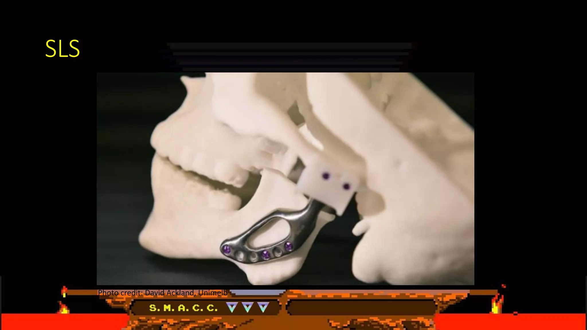 3D printing for Paediatric Anatomical models | PPT