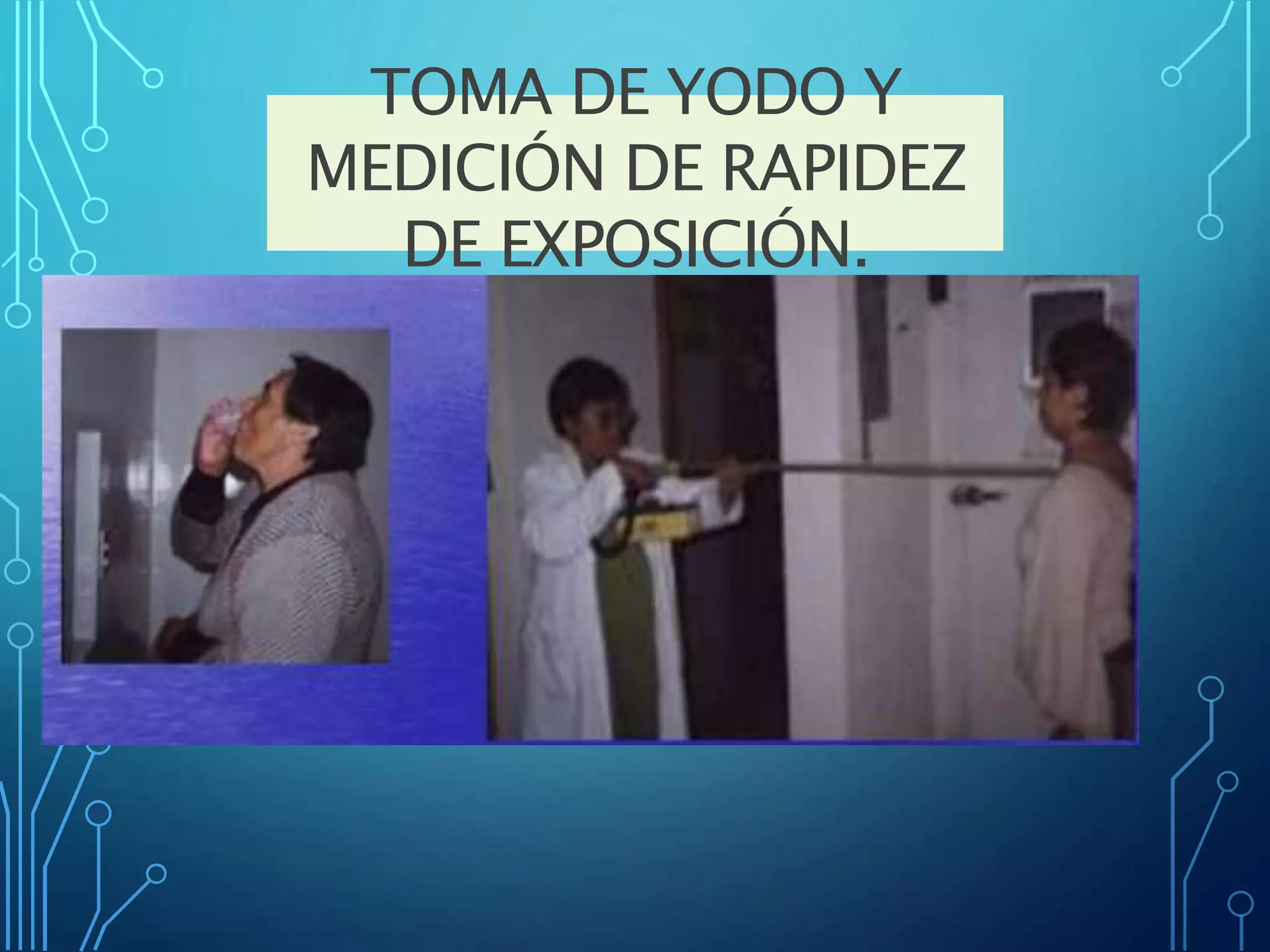 YODO RADIOACTIVO.pptx
