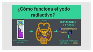 YODO RADIOACTIVO.pptx