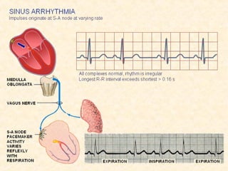 Role of Yogic Relaxation in Cardiac Rehabilitation | PPT