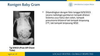 Yohan Parulian Sinaga Pneumothorax.pptx