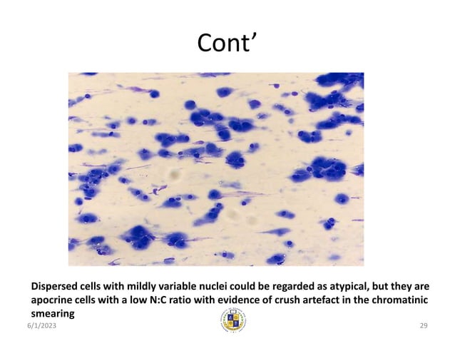 Yokohama System-Reporting Breast Fine-Needle Aspiration Biopsy (FNAB).pptx