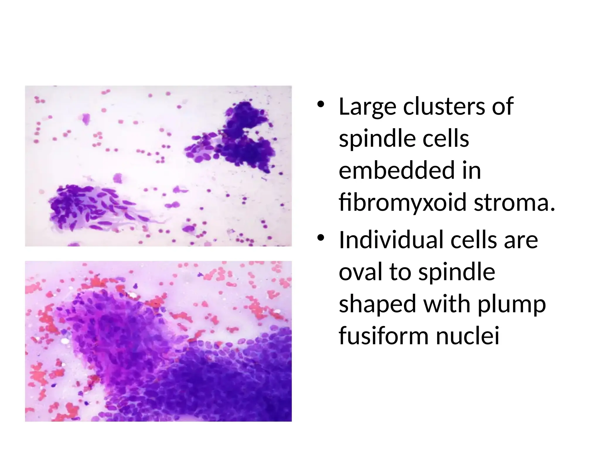 yokohamasystemcytology-190920012249.pptx
