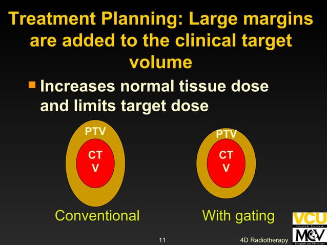 4D Radiotherapy | PPT